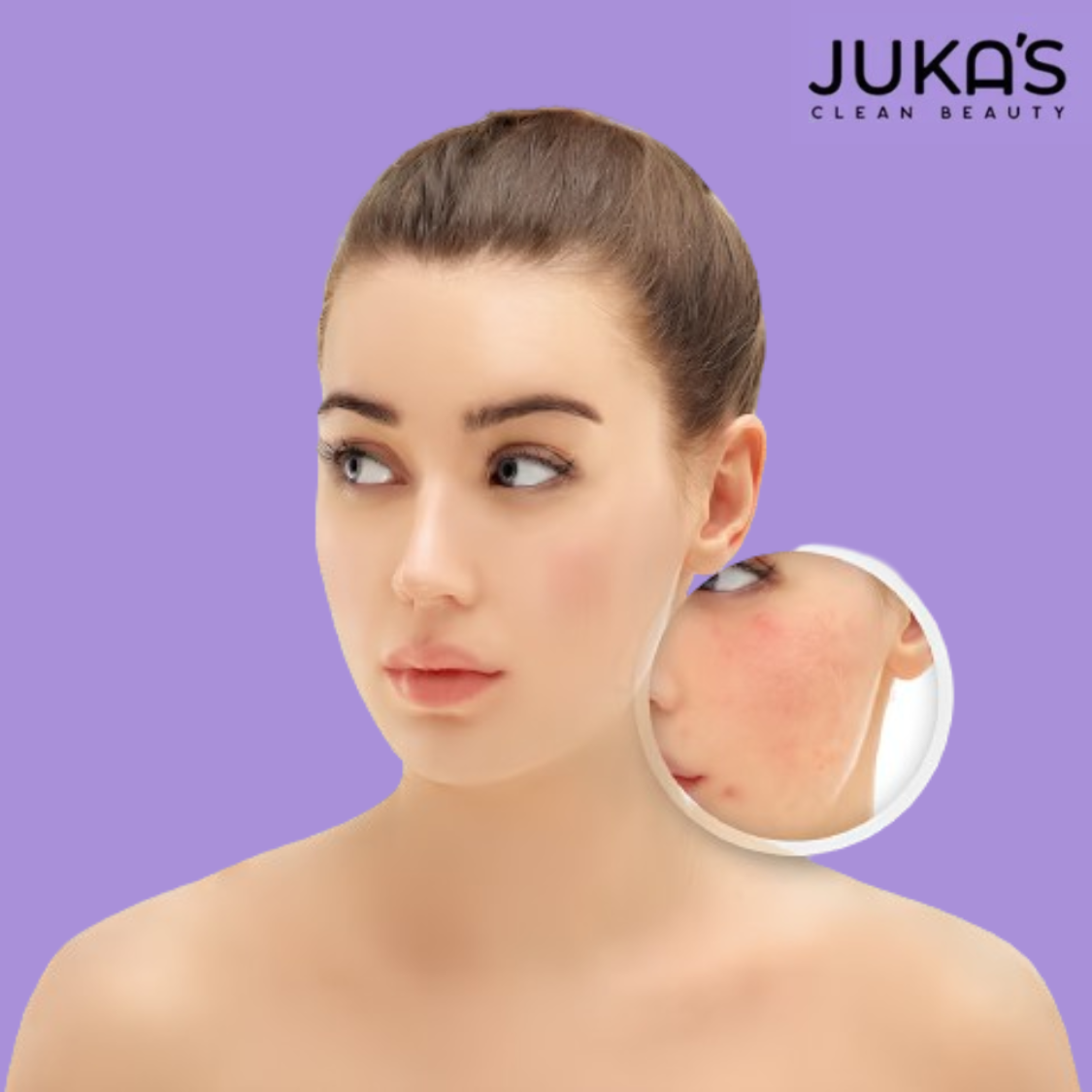 Achieve Radiant Skin with Juka's Clean Beauty Anti-Acne Kit